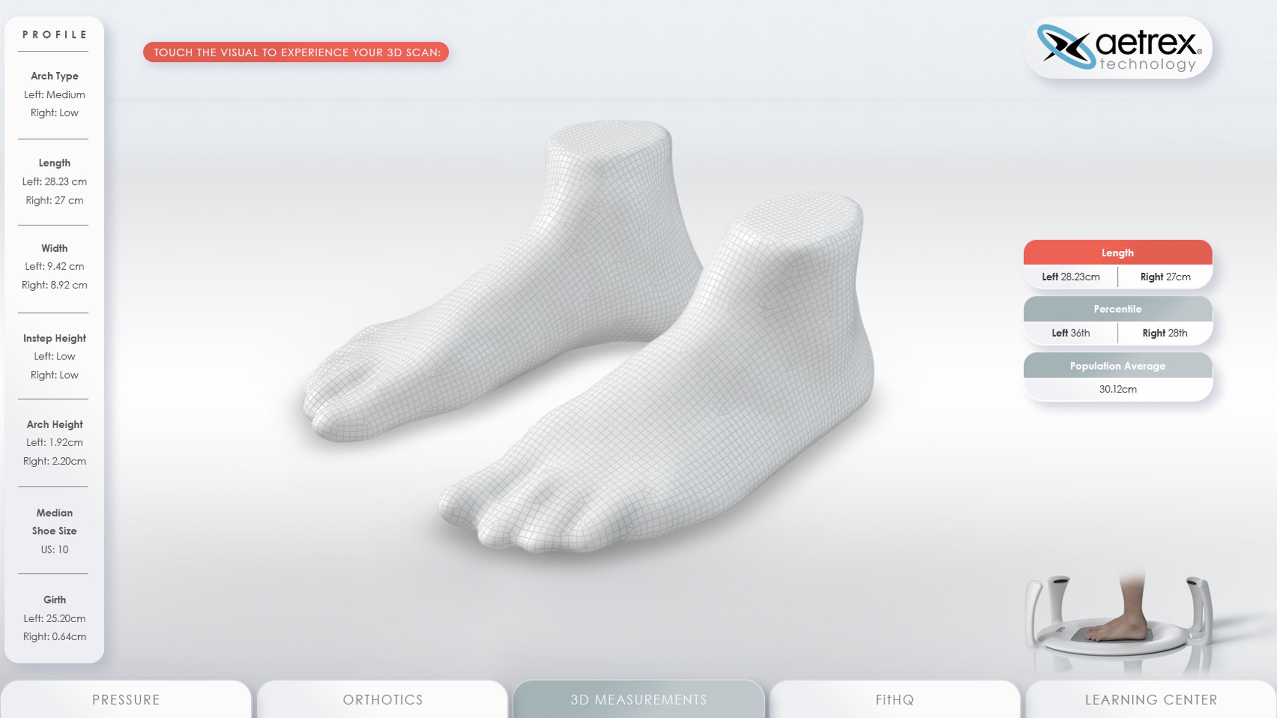 Cómo las plantillas de Aetrex pueden reducir el dolor en los pies caus ...